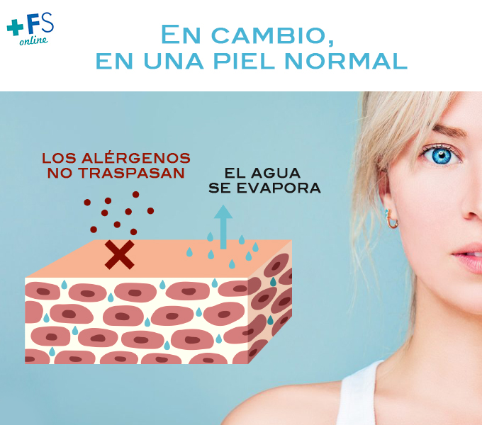¿Piel atópica? Te contamos los síntomas y tratamientos para calmar tu ...